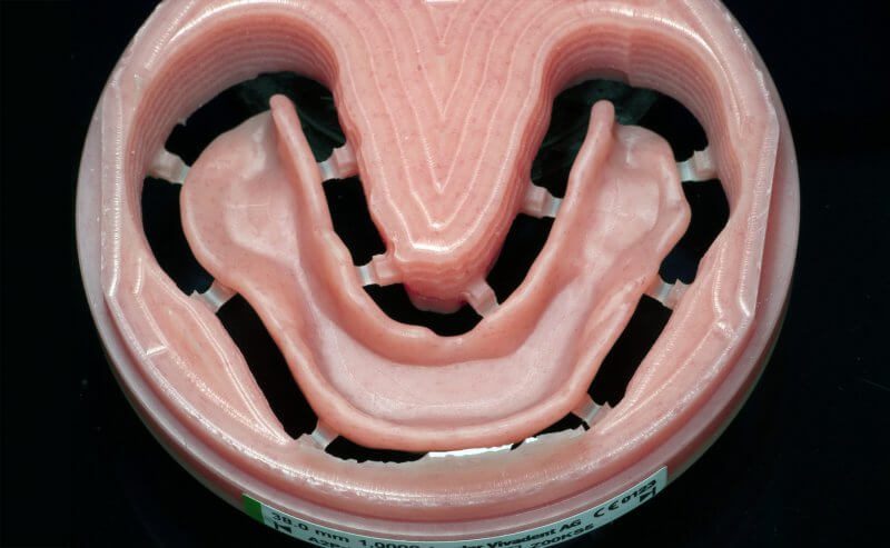 Ivotion Digital Denture System from Ivoclar Vivadent | Wiand Dental Lab