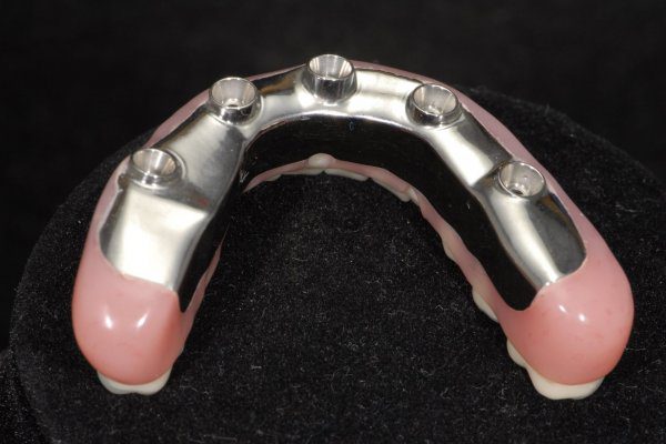 Gallery and Patient Photos - Wiand Dental Lab